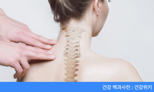 거북목 얼굴 변화 방치하면 어떻게 건강 백과사전 건강위키